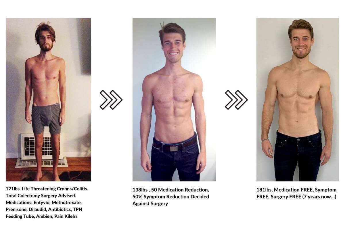transformation - Natural Healing for Crohn’s and Ulcerative Colitis