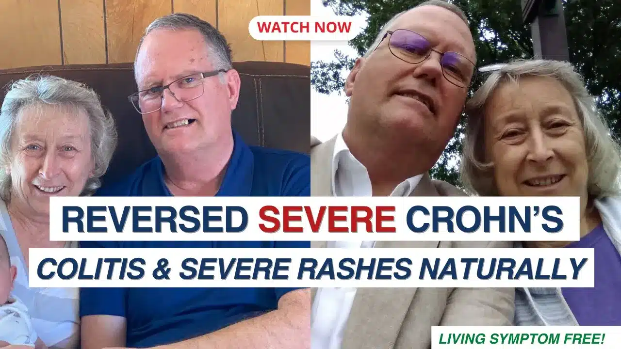Janet Beats Crohn’s, Colitis & Severe Rashes Naturally After a Decade ...